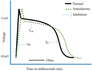Amiodarone: A Comprehensive Guide for Clinicians | SpringerLink