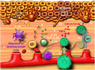 Vitiligo: An Update on Pathophysiology and Treatment Options | SpringerLink