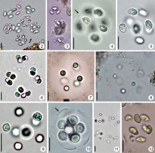 Planktonic Radiococcaceae Fott ex Komárek of the Tigres Lake system ...