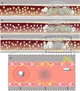 Ultrasound Cavitation/Microbubble Detection and Medical Applications ...