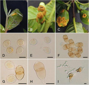 Epitypification of Puccinia psidii , Causal Agent of Guava Rust ...