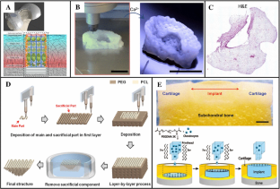 3D bioprinting: an emerging technology full of opportunities and ...