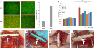 3D printing of hydroxyapatite/tricalcium phosphate scaffold with hierarchical porous structure ...