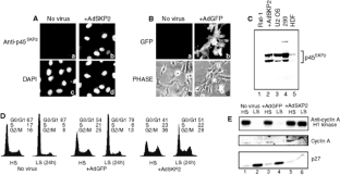 p45 SKP2 promotes p27 Kip1 degradation and induces S phase in quiescent ...