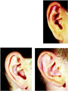 Of vulcan ears, human ears and 'earprints' | Nature Neuroscience