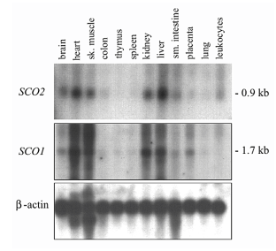 Fatal infantile cardioencephalomyopathy with COX deficiency and ...