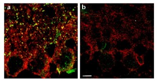 Postsynaptic clustering of major GABA A receptor subtypes requires the ...