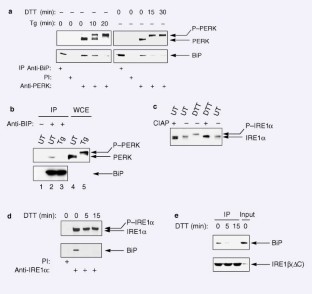 Dynamic interaction of BiP and ER stress transducers in the unfolded ...