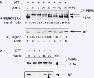 Dynamic interaction of BiP and ER stress transducers in the unfolded ...