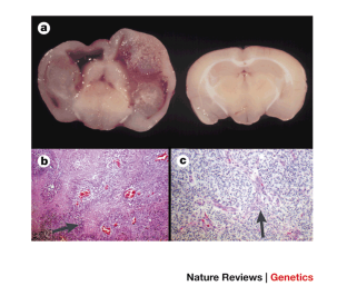 Gliomagenesis: genetic alterations and mouse models | Nature Reviews ...