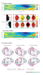 The brainweb: Phase synchronization and large-scale integration | Nature Reviews Neuroscience