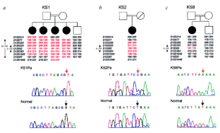 Mutations in the gene encoding the human matrix Gla protein cause ...