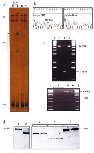 Mutations truncating the EP300 acetylase in human cancers | Nature Genetics