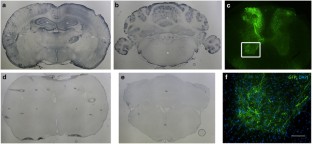 Intracerebroventricular delivery of self-complementary adeno-associated ...