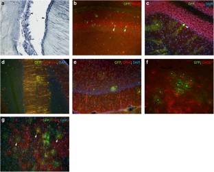 Intracerebroventricular delivery of self-complementary adeno-associated ...