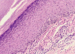 Diagnosis: Feline Plasmacytic Pododermatitis | Lab Animal