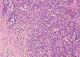 Diagnosis: Feline Plasmacytic Pododermatitis | Lab Animal