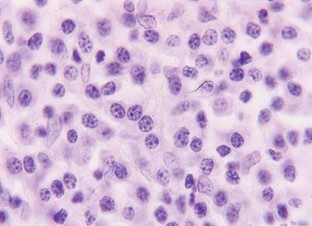 Diagnosis: Feline Plasmacytic Pododermatitis | Lab Animal