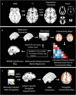 Dimensional depression severity in women with major depression and post ...