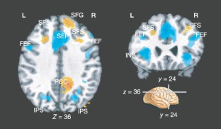 A general mechanism for perceptual decision-making in the human brain ...