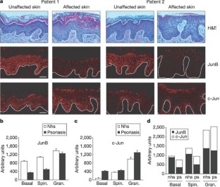 Psoriasis-like skin disease and arthritis caused by inducible epidermal ...
