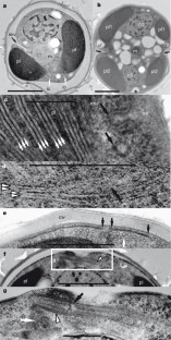 A photosynthetic alveolate closely related to apicomplexan parasites ...
