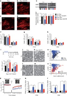 Intranasal epidermal growth factor treatment rescues neonatal brain ...
