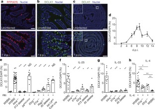 Tuft-cell-derived IL-25 regulates an intestinal ILC2–epithelial ...