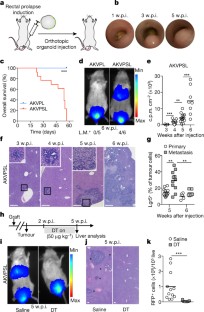 A distinct role for Lgr5 + stem cells in primary and metastatic colon ...