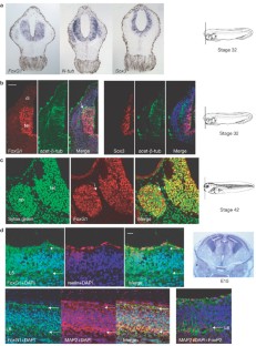 The neural progenitor-specifying activity of FoxG1 is antagonistically ...