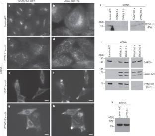 SNX4 coordinates endosomal sorting of TfnR with dynein-mediated ...