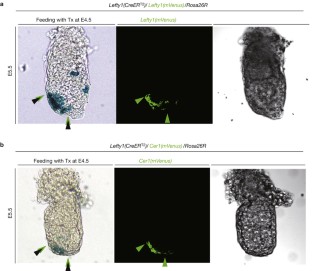 Origin and role of distal visceral endoderm, a group of cells that ...