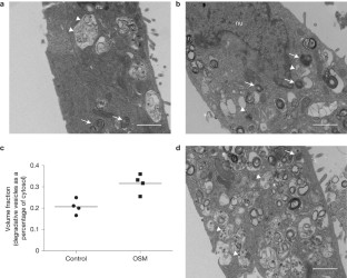 Stat3 controls cell death during mammary gland involution by regulating ...