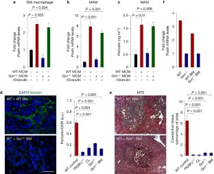 Macrophage-secreted granulin supports pancreatic cancer metastasis by ...