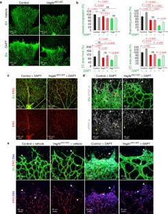 Dll4 and Notch signalling couples sprouting angiogenesis and artery ...
