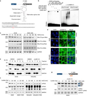 A regulated PNUTS mRNA to lncRNA splice switch mediates EMT and tumour ...