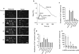 Polycystin-2 is an intracellular calcium release channel | Nature Cell ...