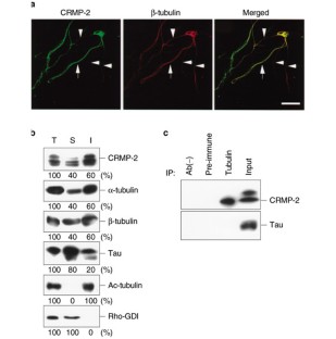CRMP-2 binds to tubulin heterodimers to promote microtubule assembly ...