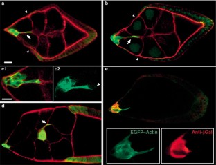 Invasive cell migration is initiated by guided growth of long cellular ...
