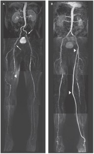 Technology Insight: magnetic resonance angiography for the evaluation ...