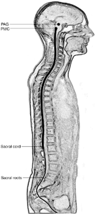 Therapy Insight: bladder dysfunction associated with multiple sclerosis ...