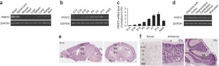 Exome sequencing identifies truncating mutations in PRRT2 that cause paroxysmal kinesigenic ...