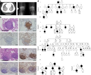 COPA mutations impair ER-Golgi transport and cause hereditary ...