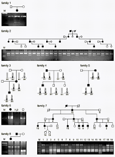Heterozygous mutations in ANKH , the human ortholog of the mouse ...