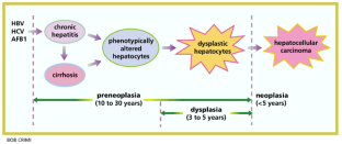 Molecular pathogenesis of human hepatocellular carcinoma | Nature Genetics