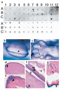 Fraser syndrome and mouse blebbed phenotype caused by mutations in ...