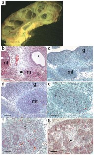 Fraser syndrome and mouse blebbed phenotype caused by mutations in ...