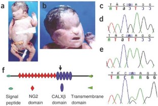 Identification of a new gene mutated in Fraser syndrome and mouse ...