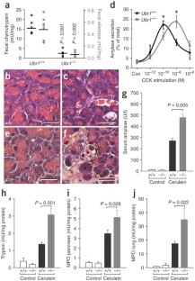 Deficiency of UBR1, a ubiquitin ligase of the N-end rule pathway ...
