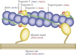 Mutations in embryonic myosin heavy chain ( MYH3 ) cause Freeman ...